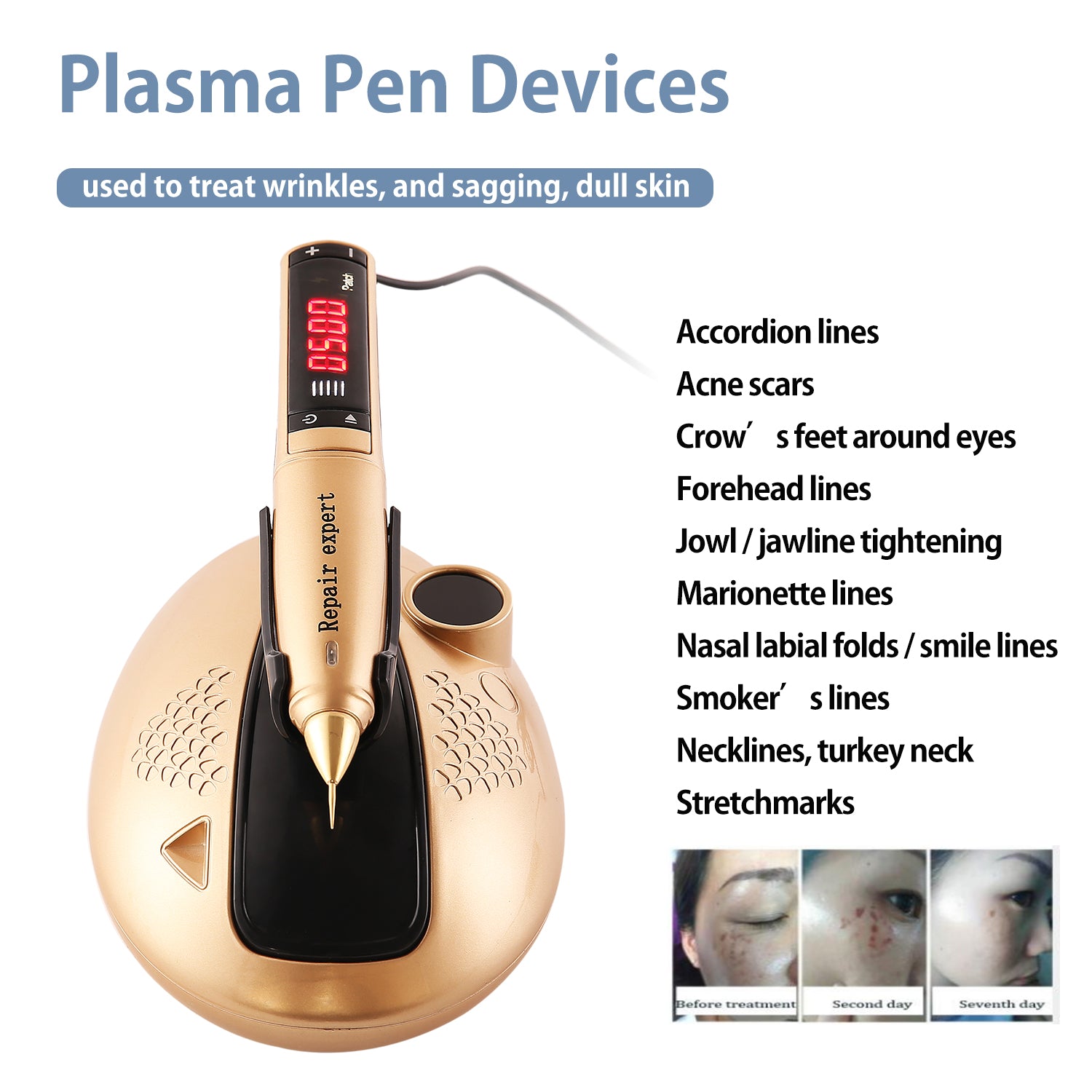 TREAT WRINKLE AND SAGGING-PLASMA PEN DEVICES-PLSA23